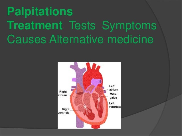 Palpitations treatment ppt
