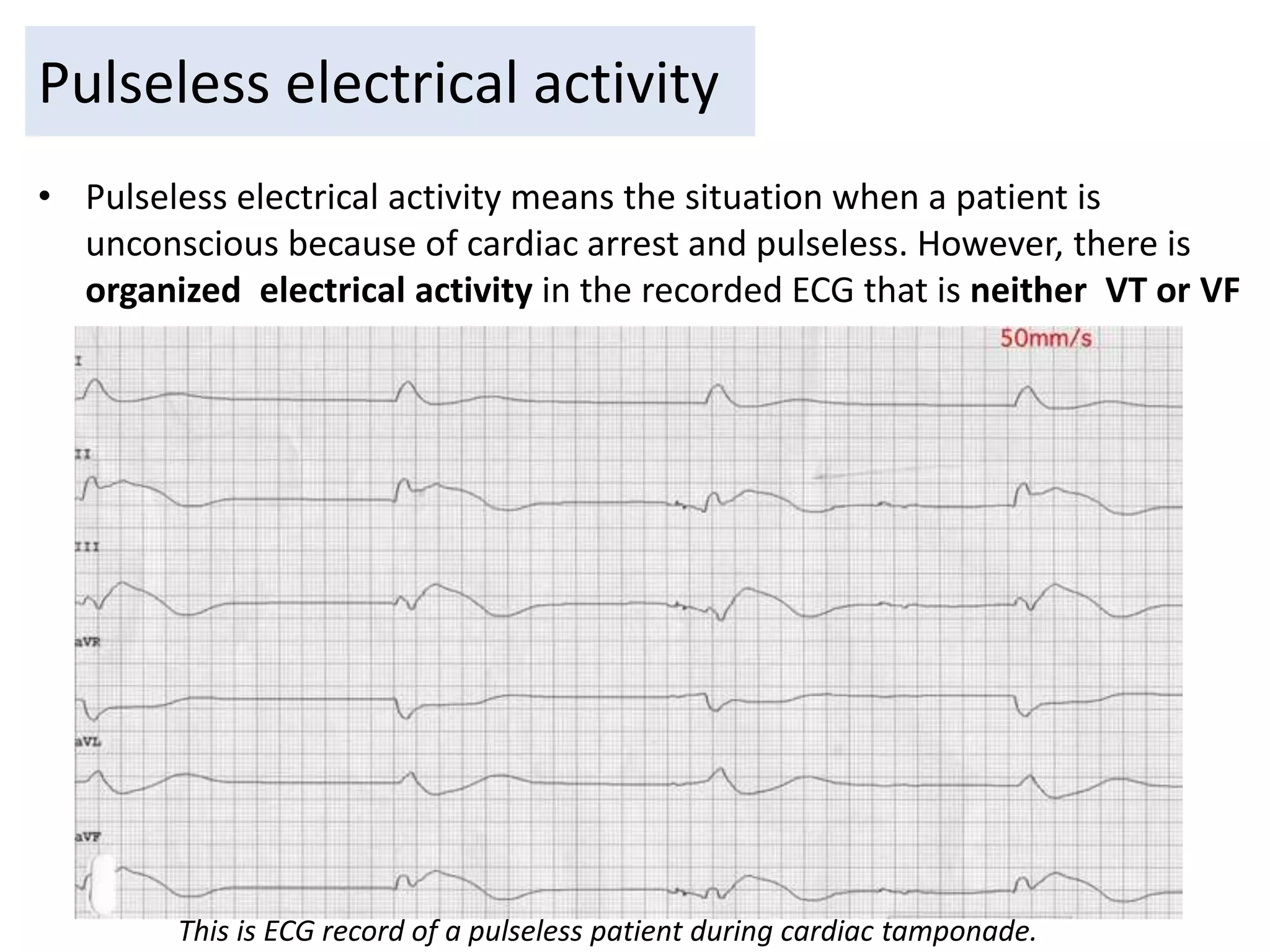 Pals 2017 part 2 | PPTX