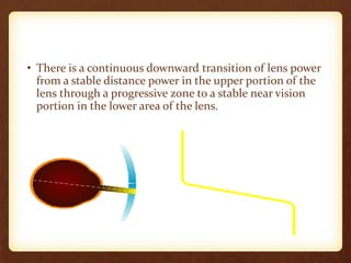 Progressive Addition Lens | PPTX