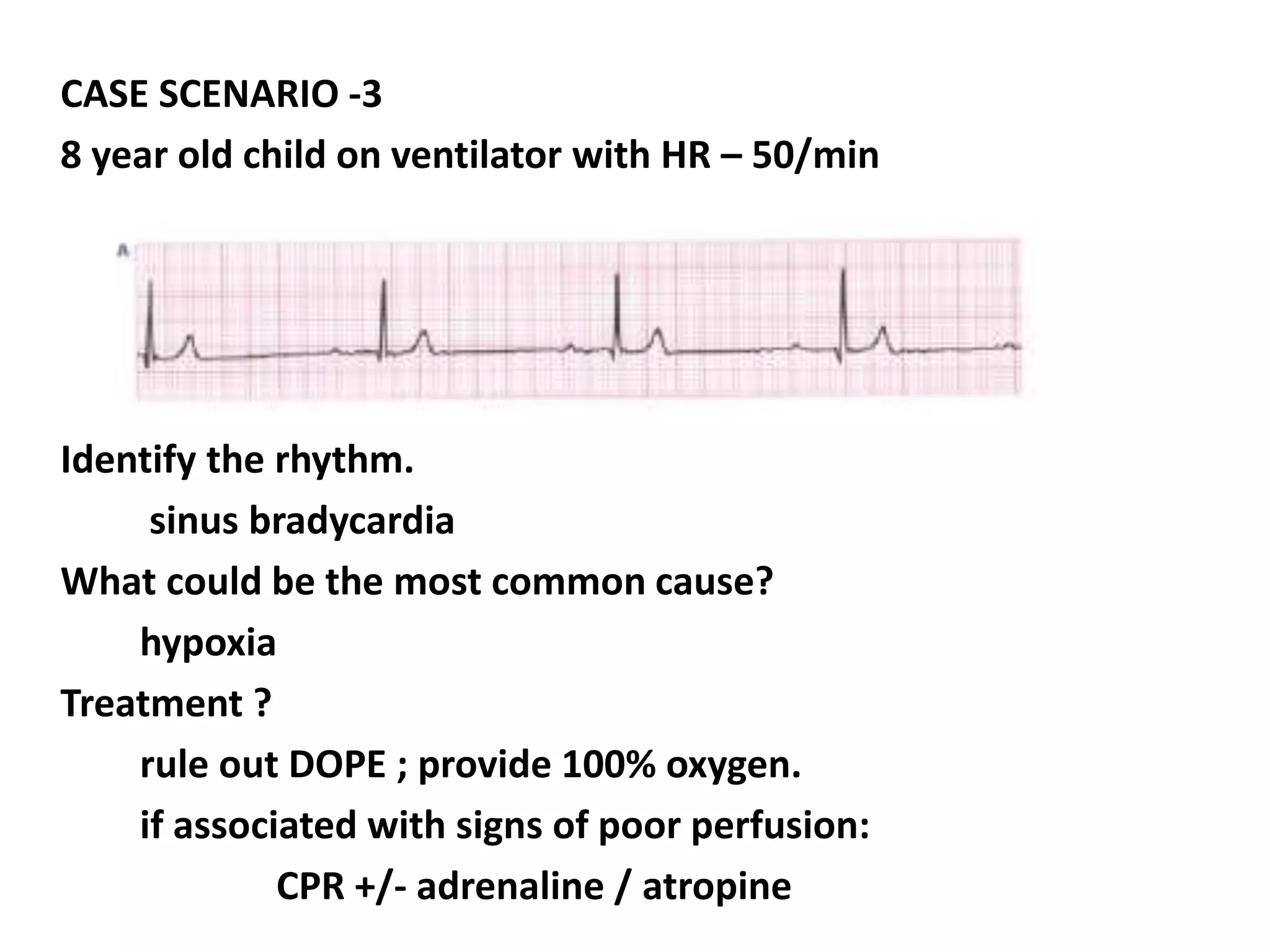 PALS NURSES REFRESHER PPT (2).pptx