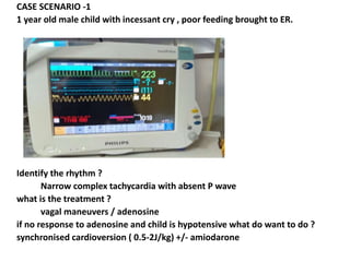 PALS NURSES REFRESHER PPT (2).pptx