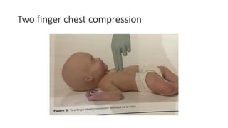 PALS resuscitation . Pediatric Advanced Life Support | PPTX