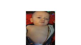 PALS resuscitation . Pediatric Advanced Life Support | PPTX