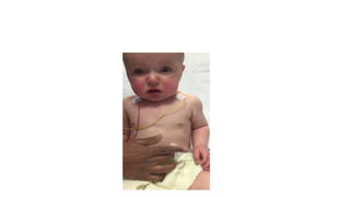 PALS resuscitation . Pediatric Advanced Life Support | PPTX