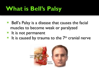 Palsy | PPT | Physical Therapy | Wellness