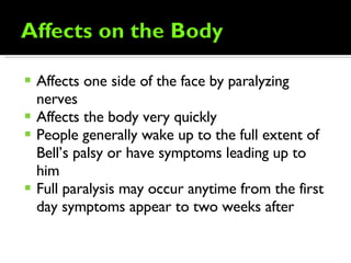 Palsy | PPT | Physical Therapy | Wellness