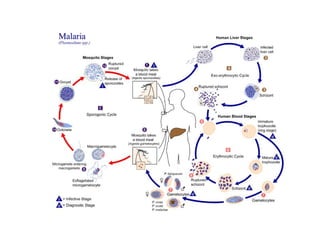 Resumen de Paludismo o Malaria 2024.pdf. | PDF