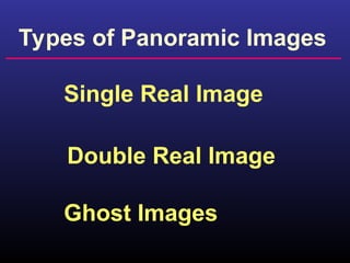panoramic radiographic landmarks in dentistry | PPT