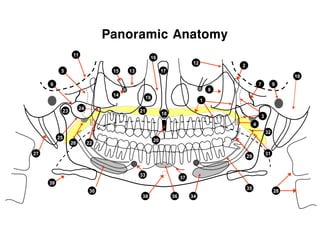 panoramic radiography landmark in dentistry | PPT