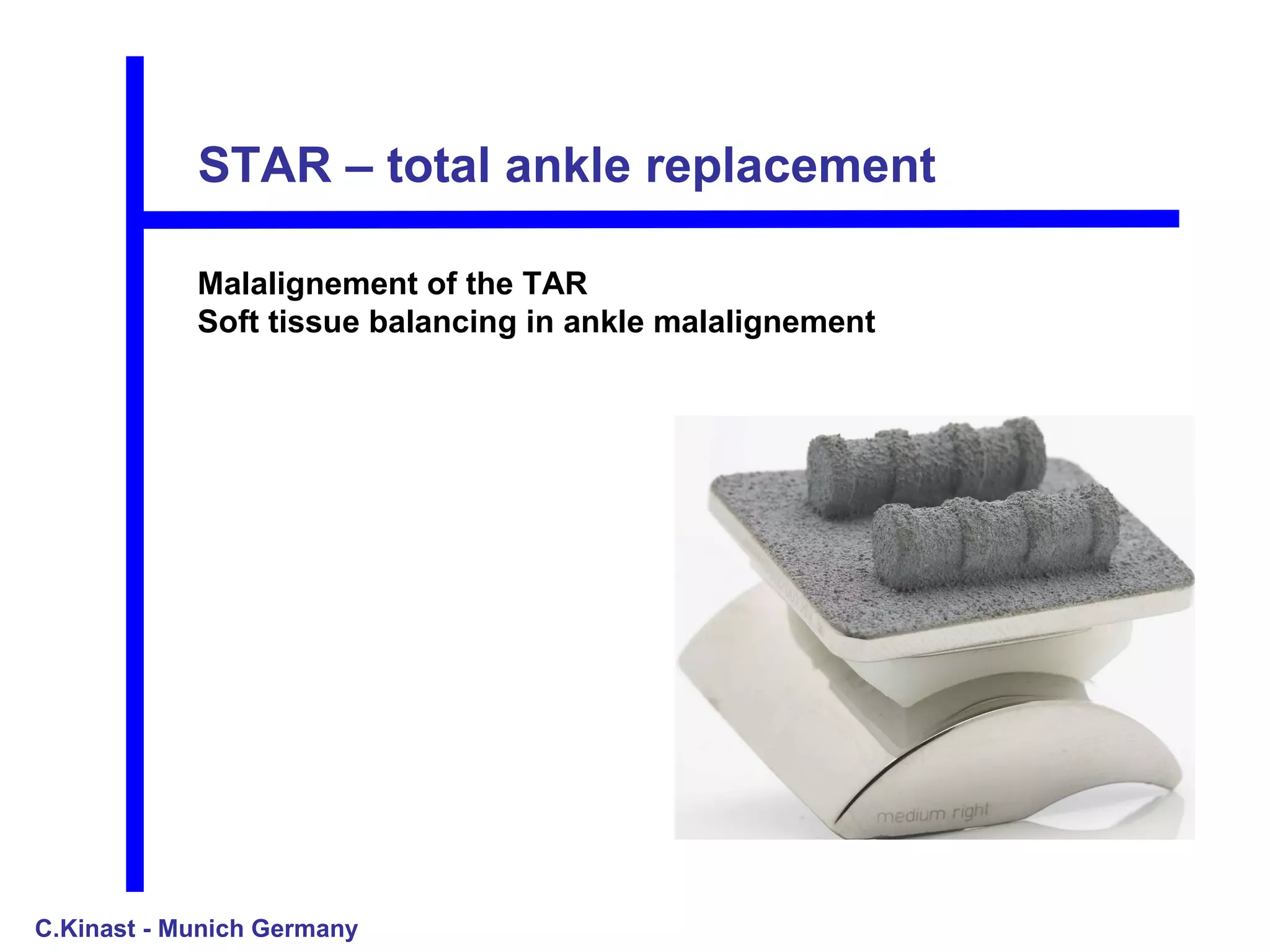 Ten Year Experience with the STAR Total Ankle Replacement | PPT