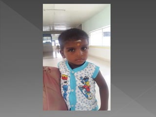 Panayiotopoulos syndrome | PPTX