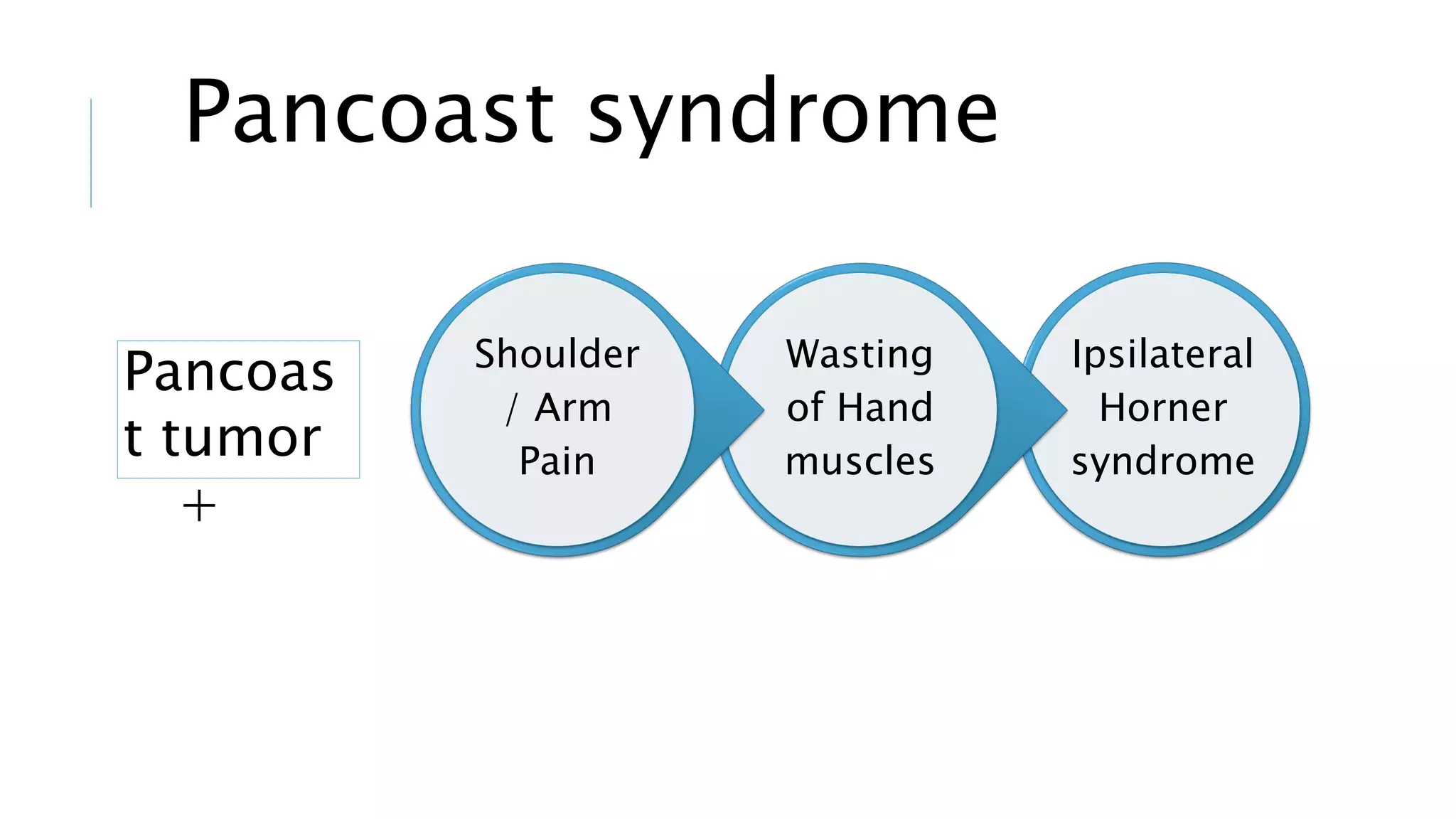 pancoast tumor.pptx