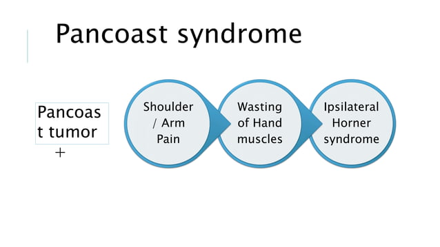pancoast tumor.pptx | Lung and Respiratory Health | Diseases and Conditions