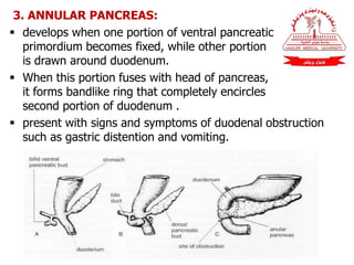 Pancreas 1 | PPT