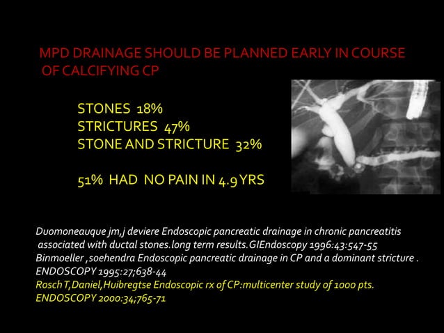 Endotherapy in Chronic Pancreatitis | PPTX