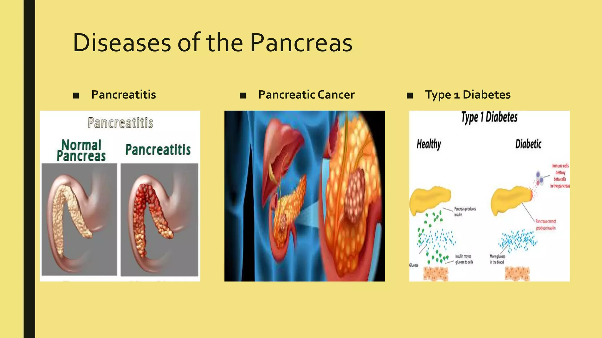 Pancreas | PPTX