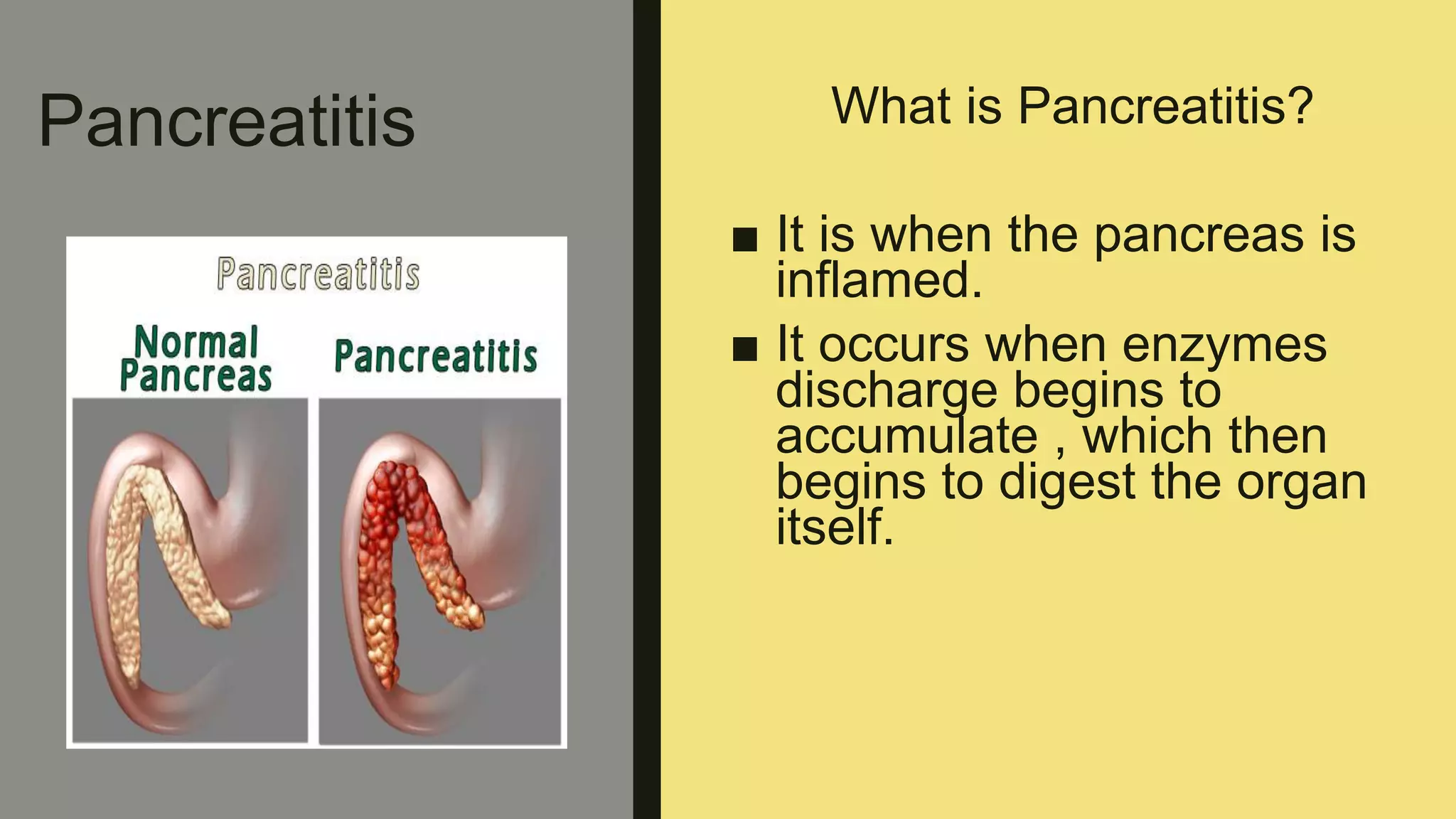 Pancreas | PPTX