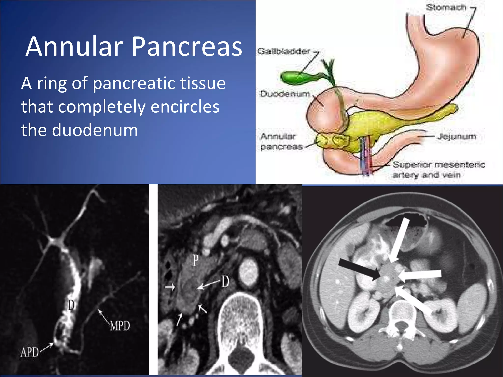 Pancreas | PPT