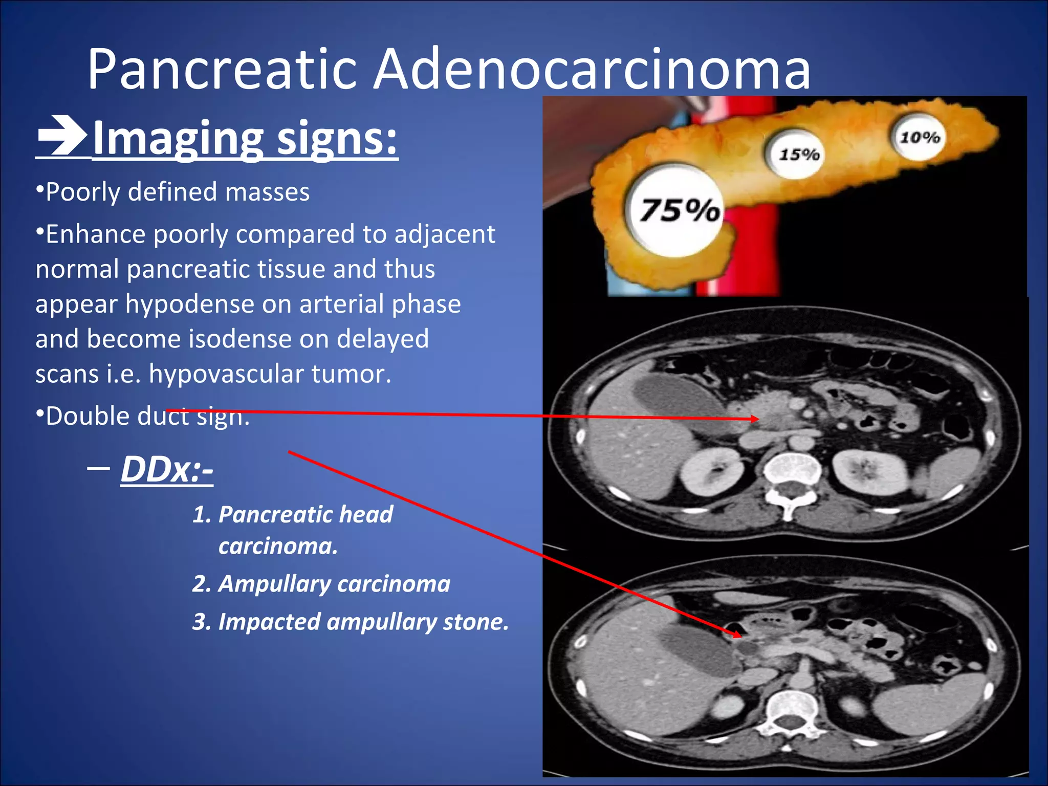 Pancreas | PPT