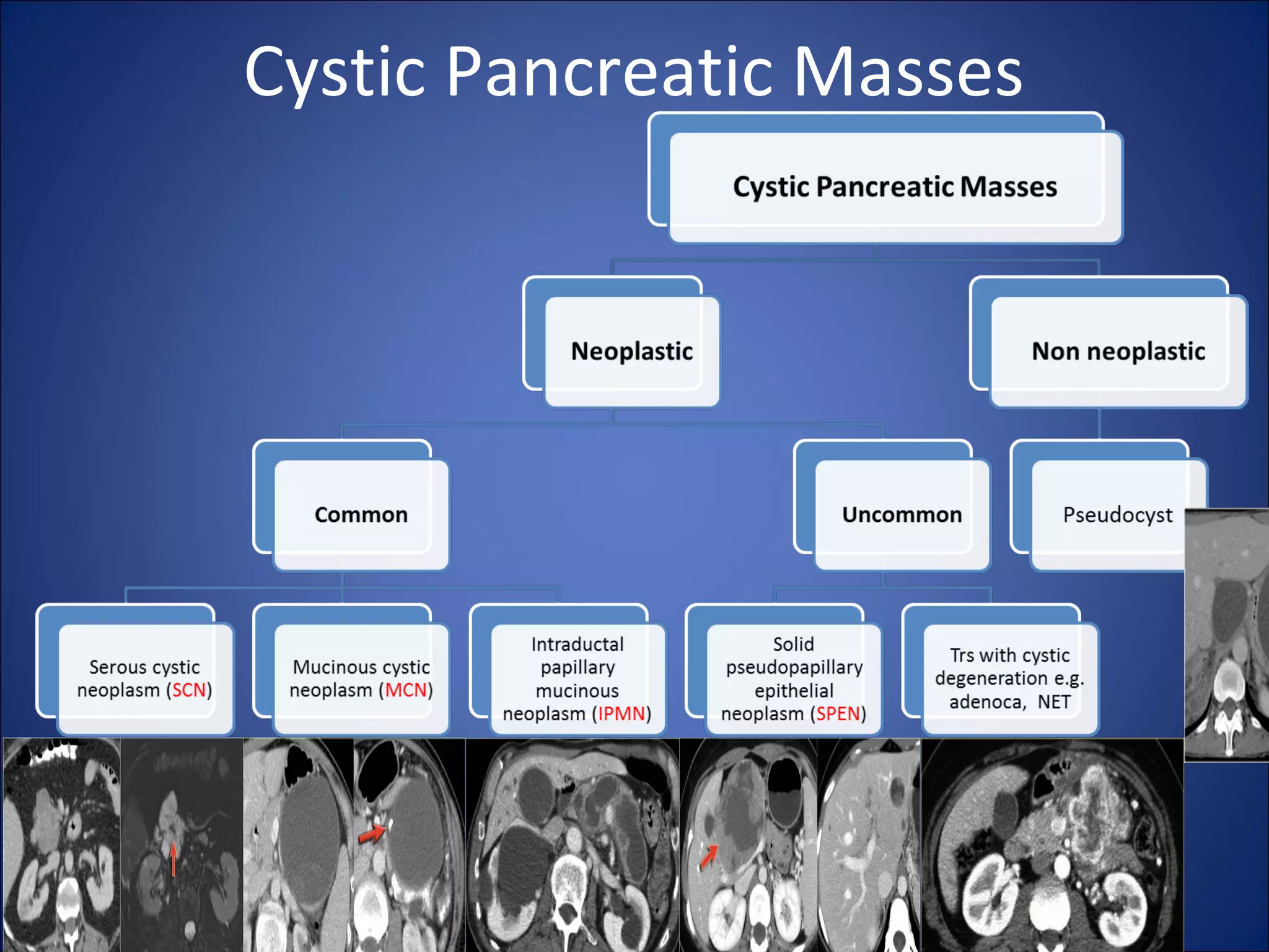 Pancreas | PPT