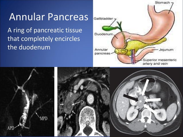Pancreas | PPT