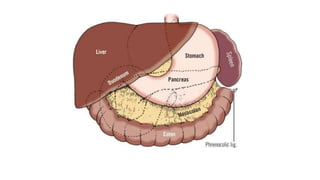 Pancreatic trauma | PPTX
