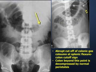 Pancreas | PPTX