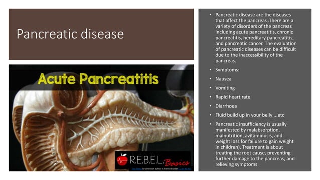 Pancreas.pptx