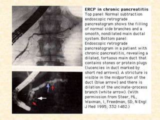 ppt on pancreas | PPT