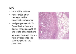 Pancreas.pdf pathology’s and diseases dysfunction | PDF | Digestive ...