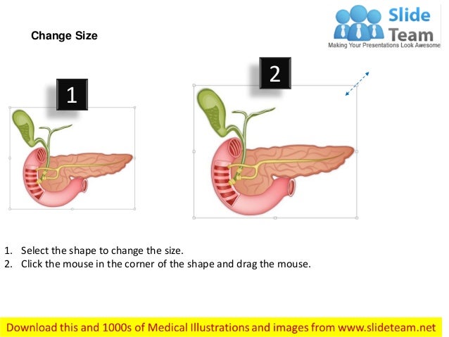 Pancreas and-gallbladder medical images for power point