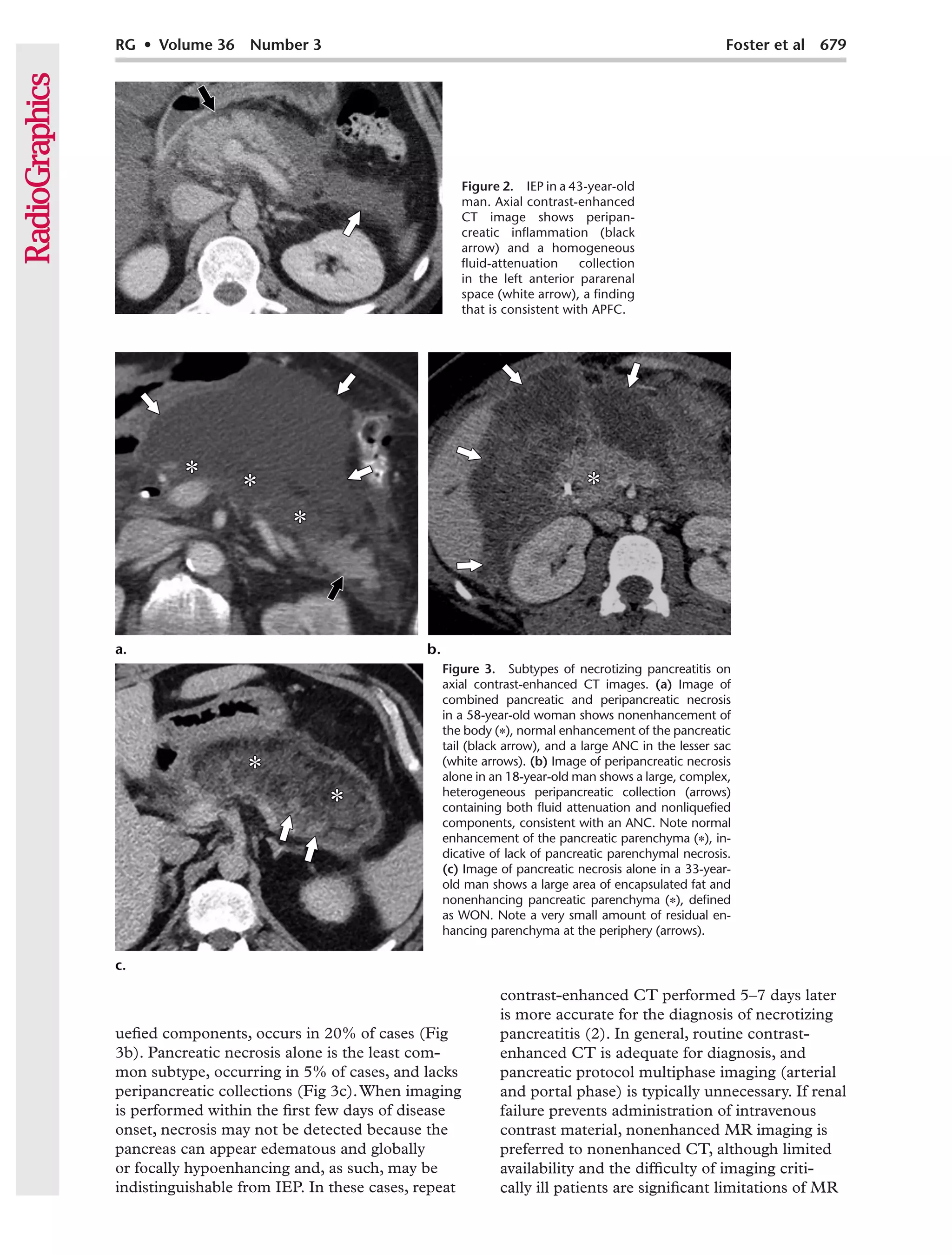 pancreas 3.pdf