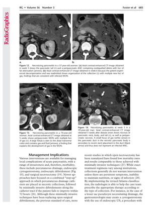 pancreas 3.pdf | Digestive Disorders | Diseases and Conditions