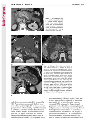 pancreas 3.pdf | Digestive Disorders | Diseases and Conditions