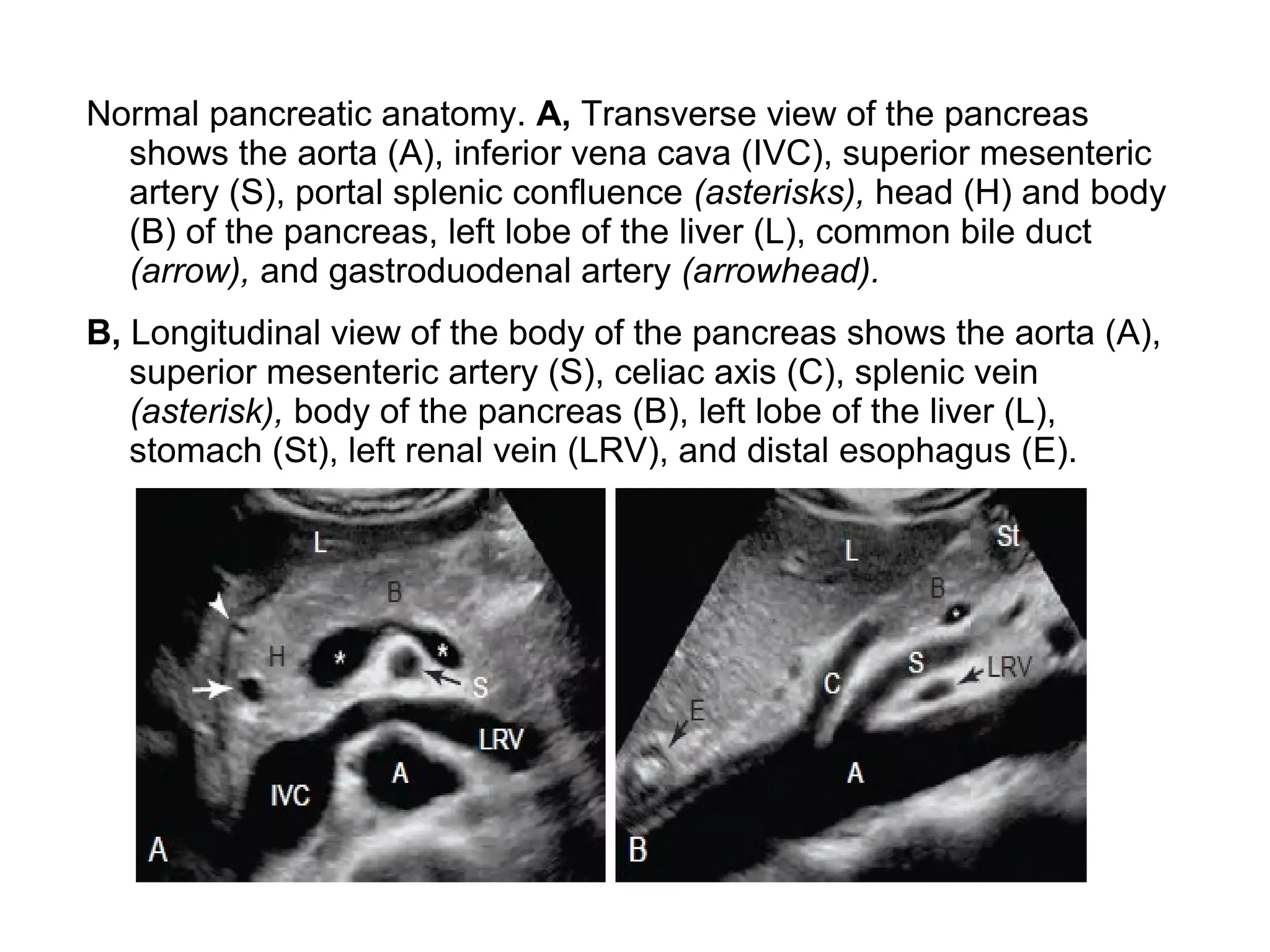Pancreas ultrasound | PPT