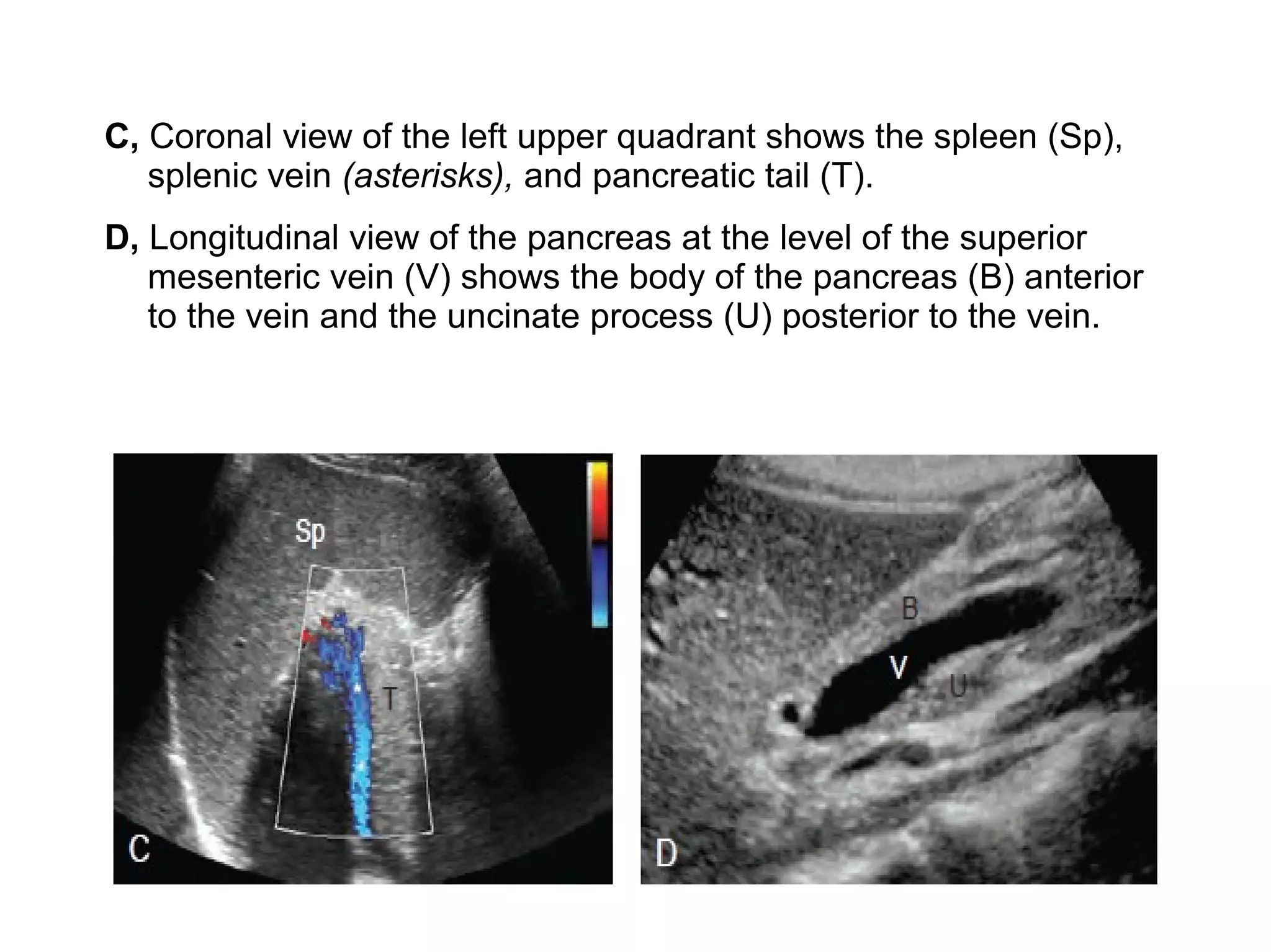 Pancreas ultrasound | PPT