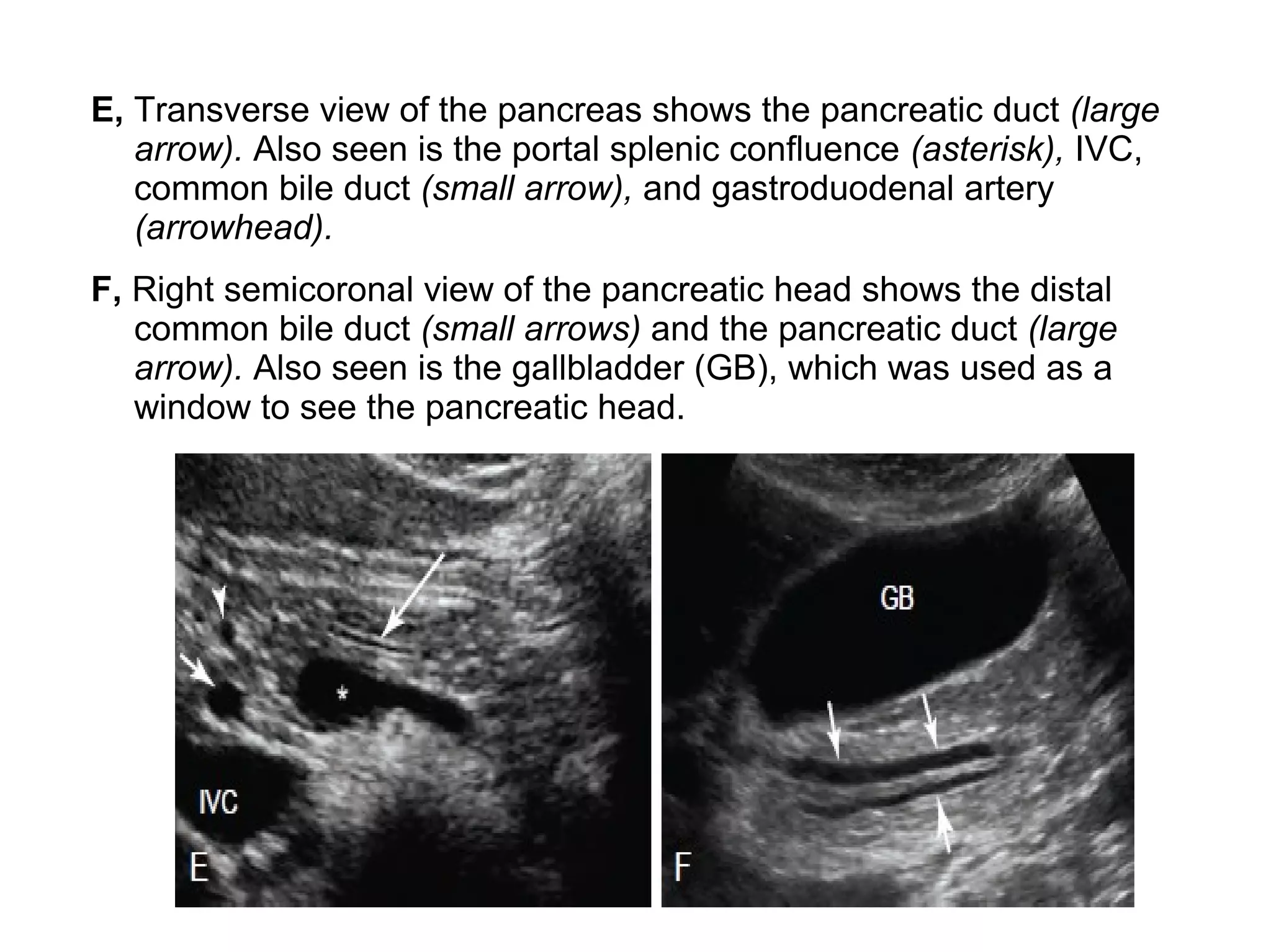 Pancreas ultrasound | PPT