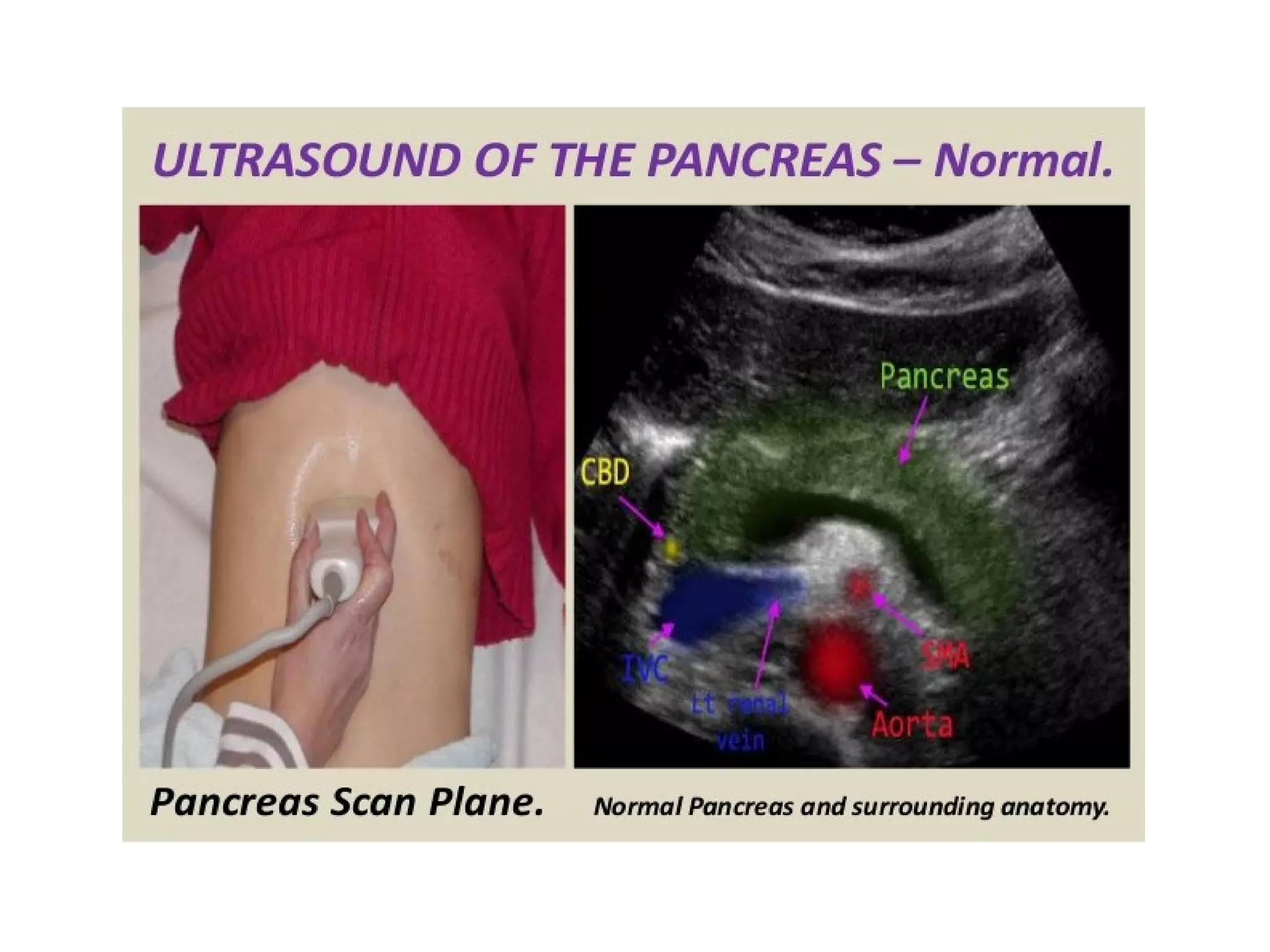 Pancreas ultrasound | PPT