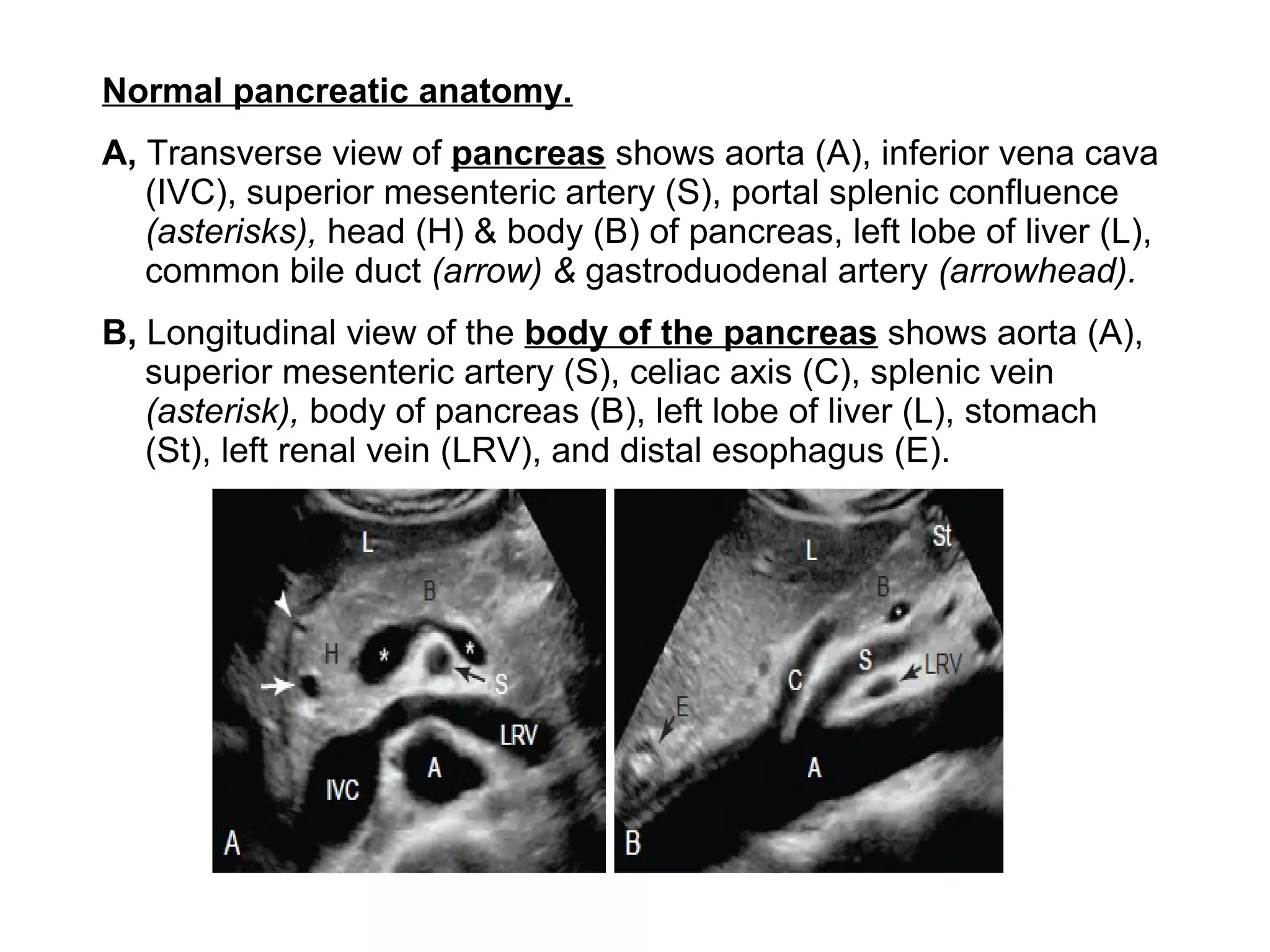 Pancreas ultrasound | PPT