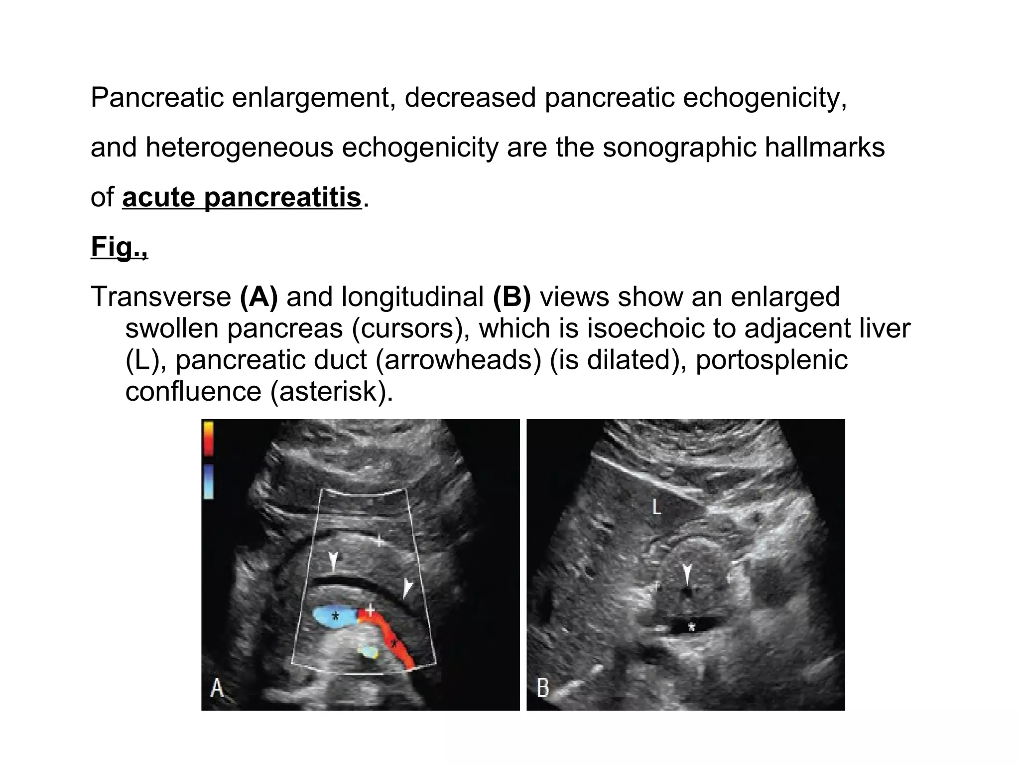 Pancreas ultrasound | PPT