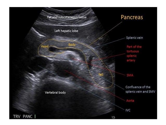 Pancreas ultrasound | PPT