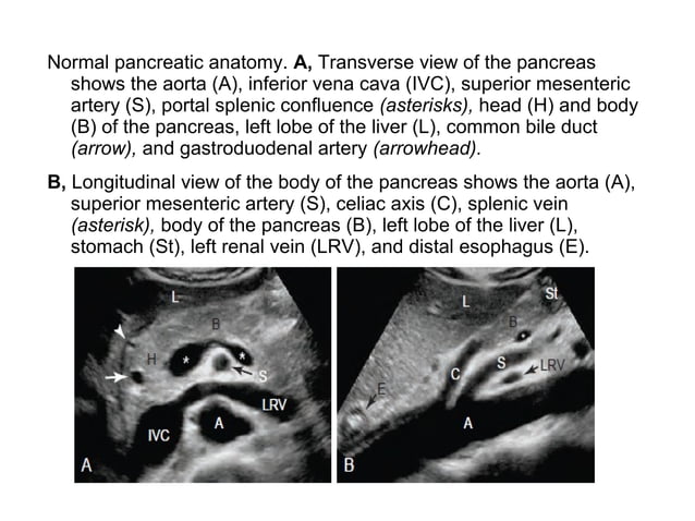 Pancreas ultrasound | PPT | Endocrine and Metabolic Diseases | Diseases ...