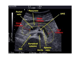 Pancreas Ultrasound