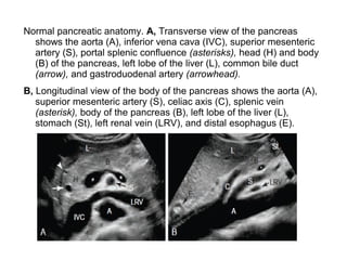Pancreas Ultrasound