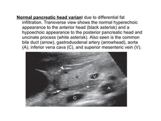 Uncinate Process Ultrasound