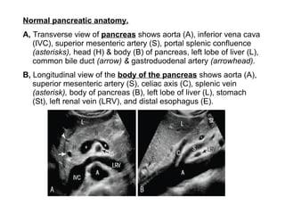 Pancreas Ultrasound Labeled