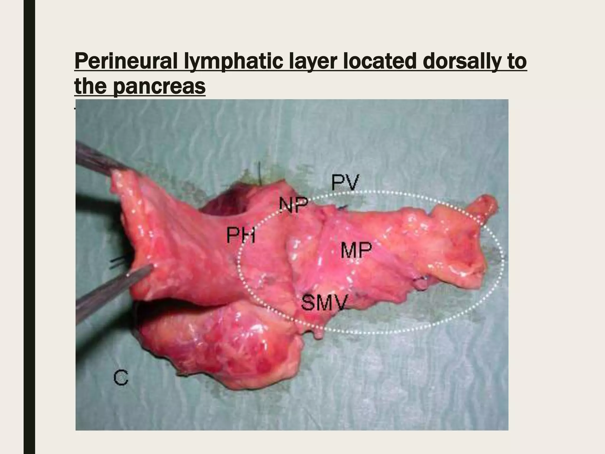 Pancreas anatomy for experts by Dr Harsh Shah(www.gastroclinix.com) | PPTX