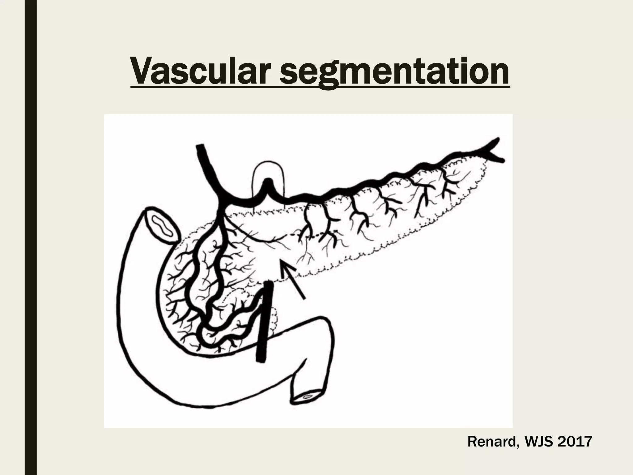 Pancreas anatomy for experts by Dr Harsh Shah(www.gastroclinix.com) | PPTX