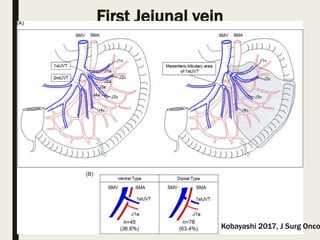 Pancreas anatomy for experts by Dr Harsh Shah(www.gastroclinix.com) | PPTX