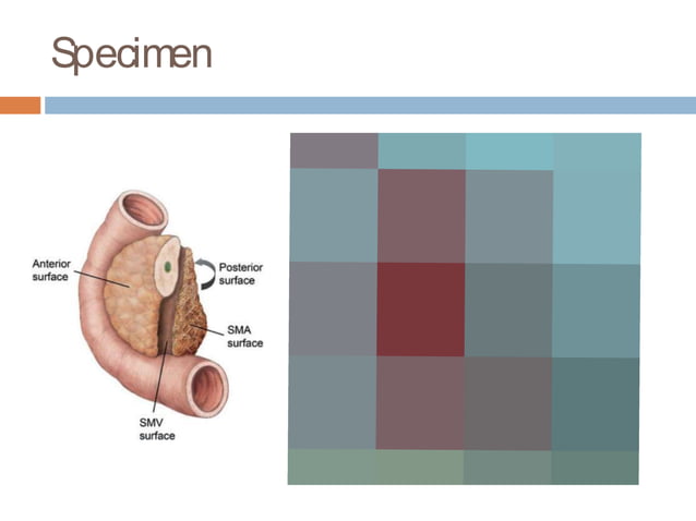 Pancreas anatomy for experts by Dr Harsh Shah(www.gastroclinix.com) | PPT